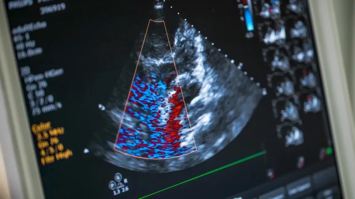 Why Choose Private Healthcare For Your Echocardiogram Test